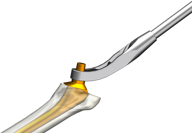 StemExtractor - endocon GmbH EN