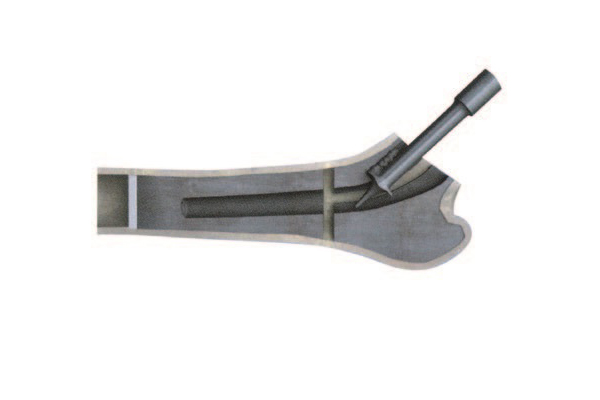 OSCAR System - endocon GmbH DE