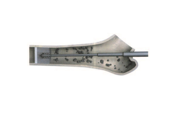 OSCAR System - endocon GmbH DE