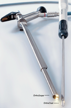 OrthoClast system - endocon GmbH EN